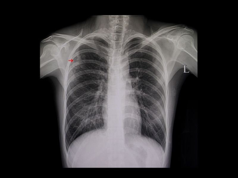 Prof. Dr. Zekeriya İlçe - Çocuk Cerrahisi Uzmanı